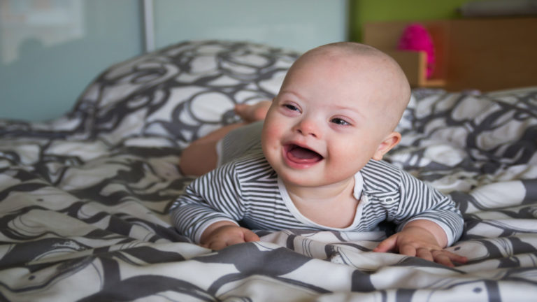 Comment prendre soin d'un bébé trisomique ? - Perinatalité